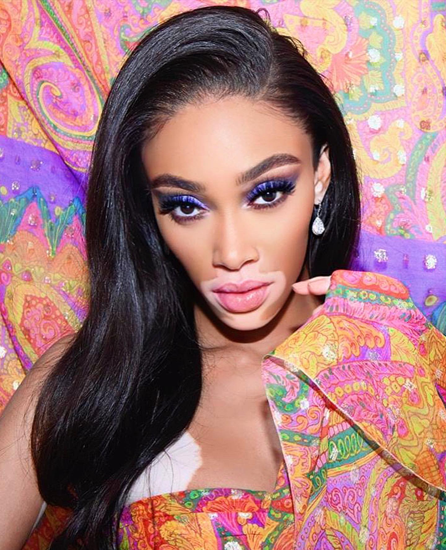 Vitiligo Models Winnie & Shahad Dominate Vogue Arabia, Read The ...