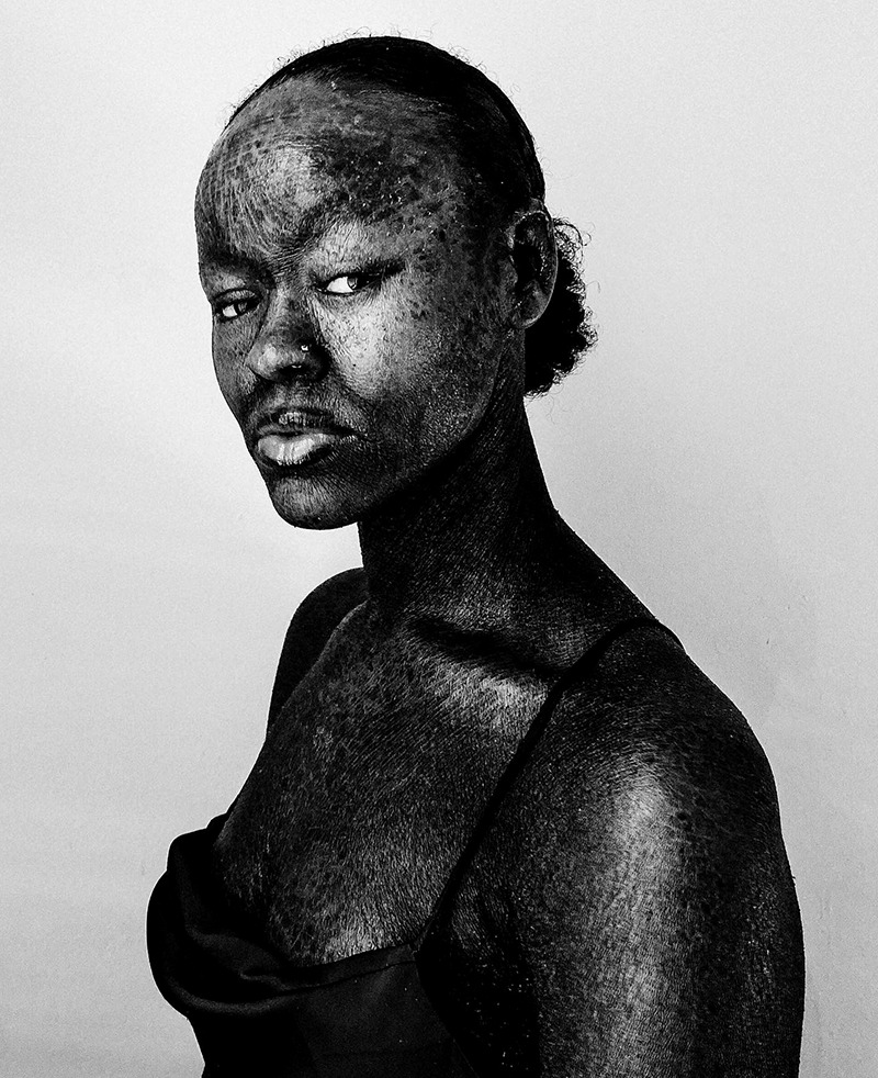 #MODELCRUSH: "I Never Saw Models With My (Rare 1 in 100,000) Skin ...